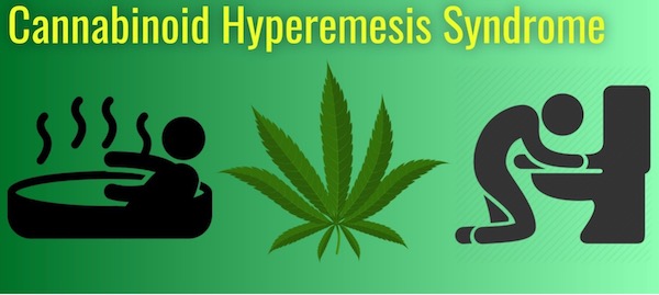 Cannabinoid Hyperemesis Syndrome: When cannabis causes the pain - The ...
